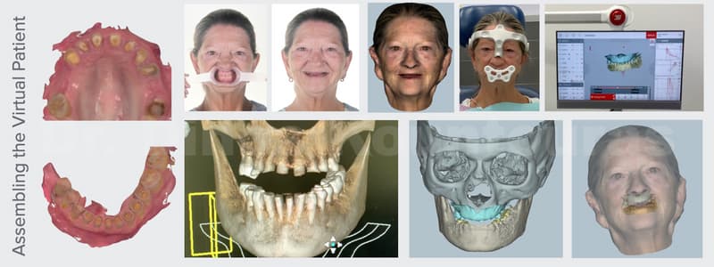 Digital Workflow Journey With Facially Generated Full Mouth Rehabilitation